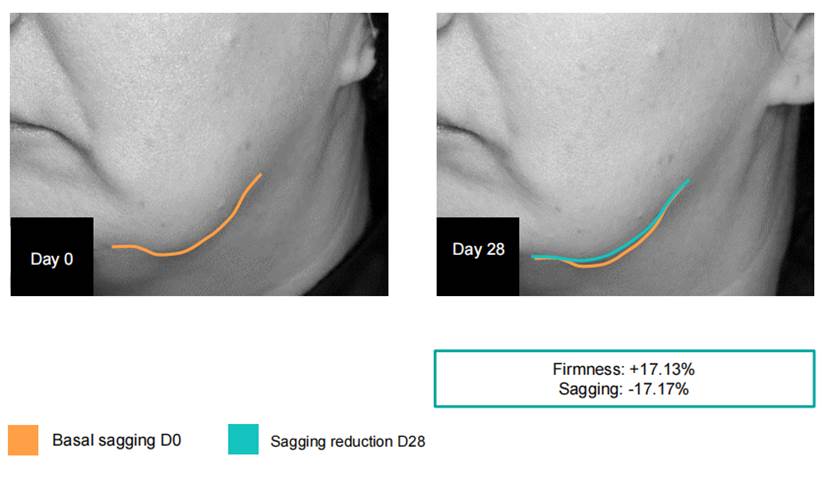 植物视黄醇+环肽，新抗老原料CycloRetin怕不是要逆天？–真魅博客