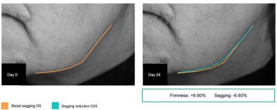 神仙打架 | 植物A醇及其功效大盘点–真魅博客