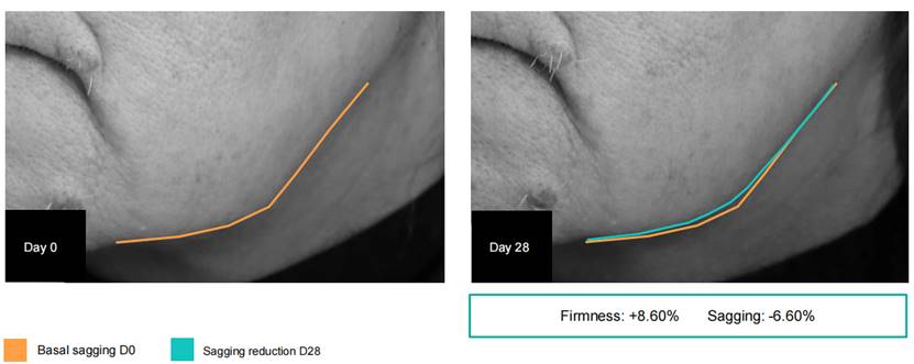 神仙打架 | 植物A醇及其功效大盘点–真魅博客